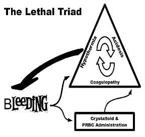 Massive Transfusion Protocol - Broome Docs
