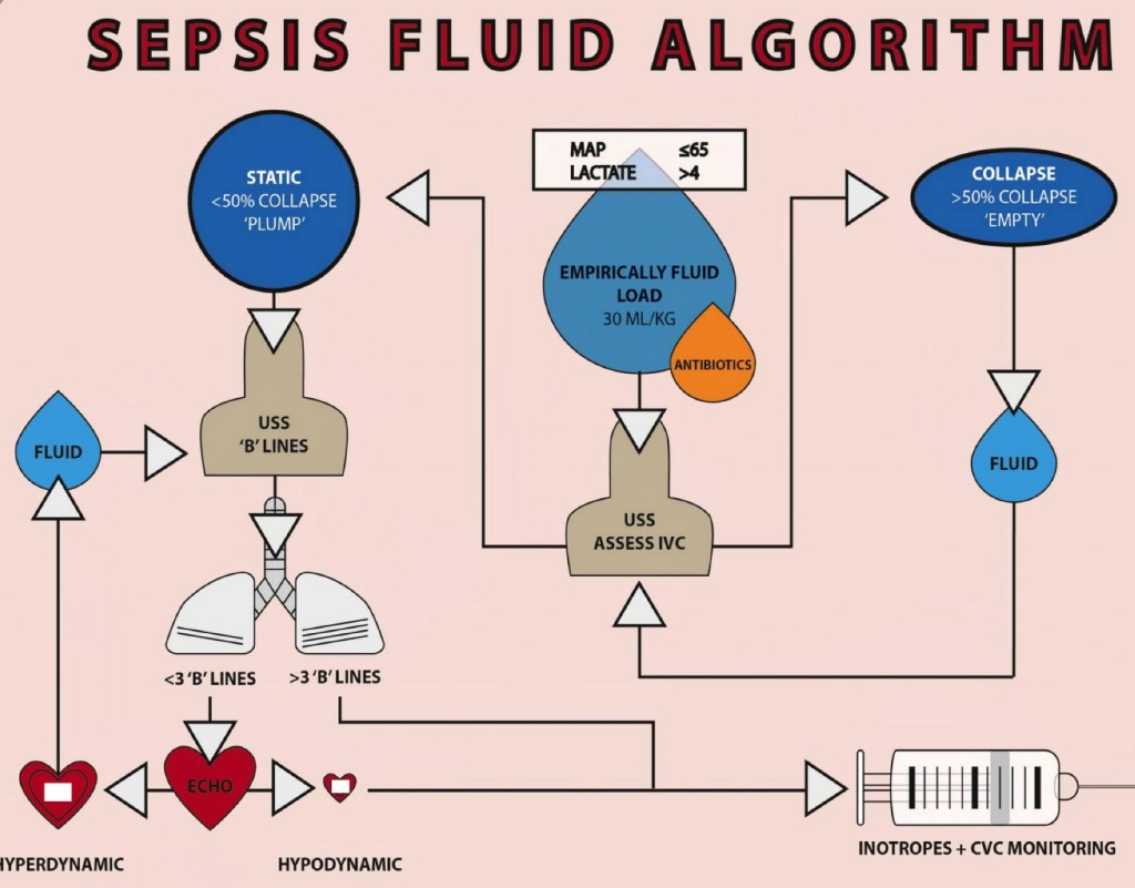 Sepsis Kimberley style: Fluid Management by Dr James Wright - Broome Docs